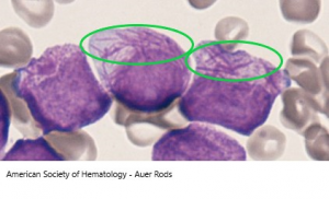 Excite Your Inner Science Nerd - Find RBC & WBC Inclusions! - Med Lab ...