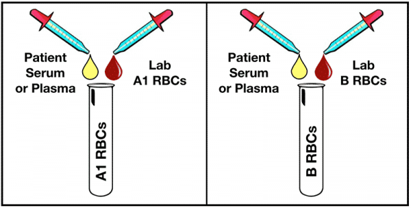 ABO Discrepancies - When Blood Typing Doesn't Match - Med Lab Study Hall