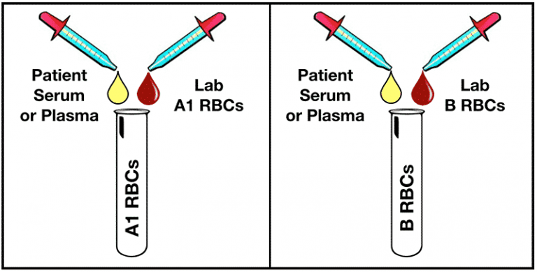 ABO Discrepancies - When Blood Typing Doesn't Match - Med Lab Study Hall