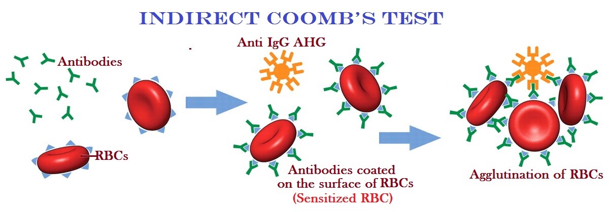Agglutination and Blood Groups - Med Lab Study Hall