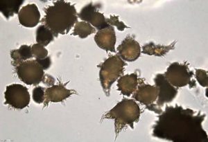 Examining Crystals in Urine Sediment - Med Lab Study Hall