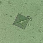Examining Crystals in Urine Sediment - Med Lab Study Hall
