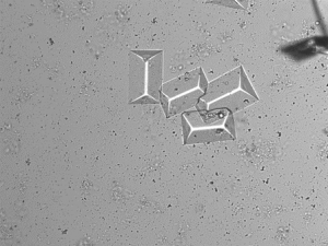 Examining Crystals in Urine Sediment - Med Lab Study Hall