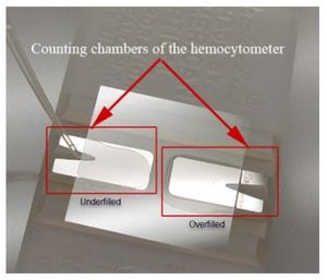 Hemacytometer Counts - Med Lab Study Hall
